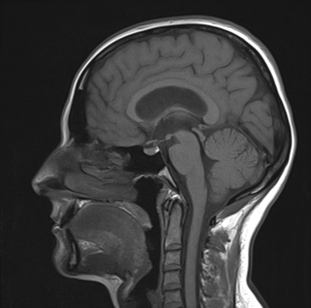 Radiologie MC3 | IRM - Radiologie MC3
